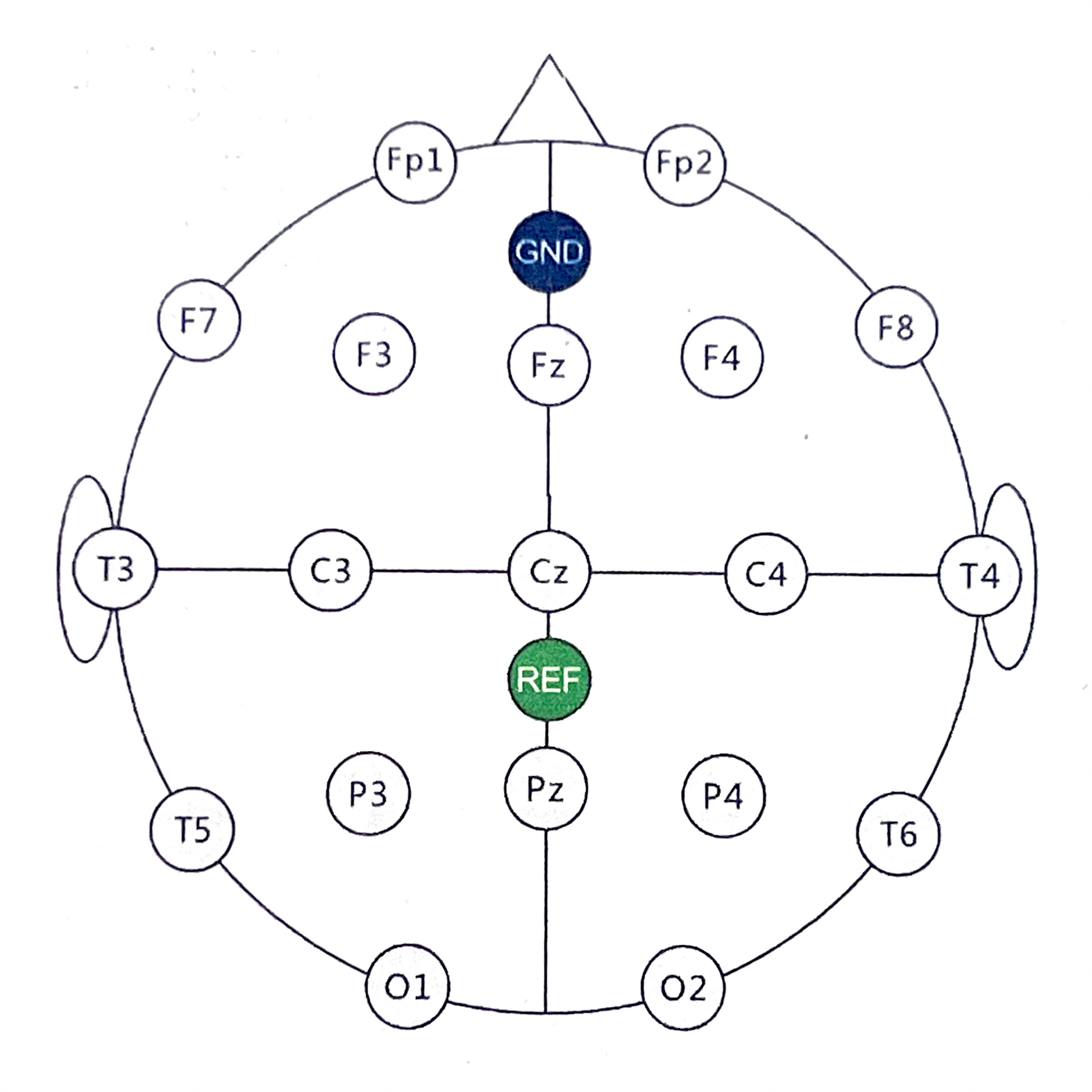 Gelfree BCI Electrode Cap Kit – OpenBCI Shop